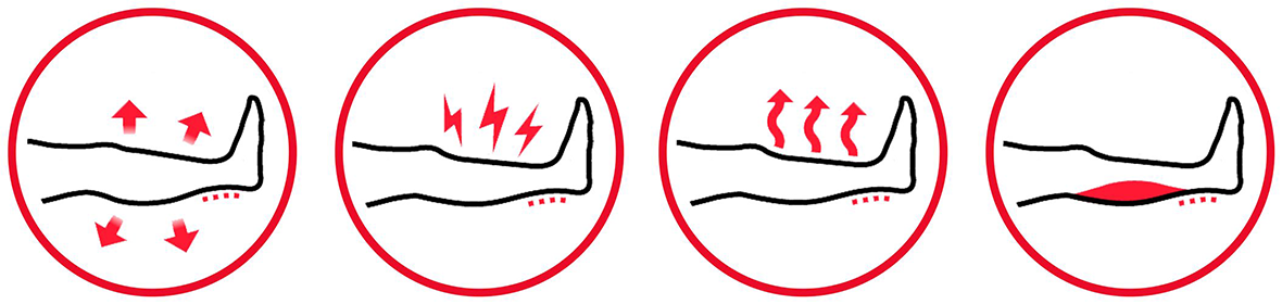 Why DVT Prevention Is Important | Cardinal Health Canada